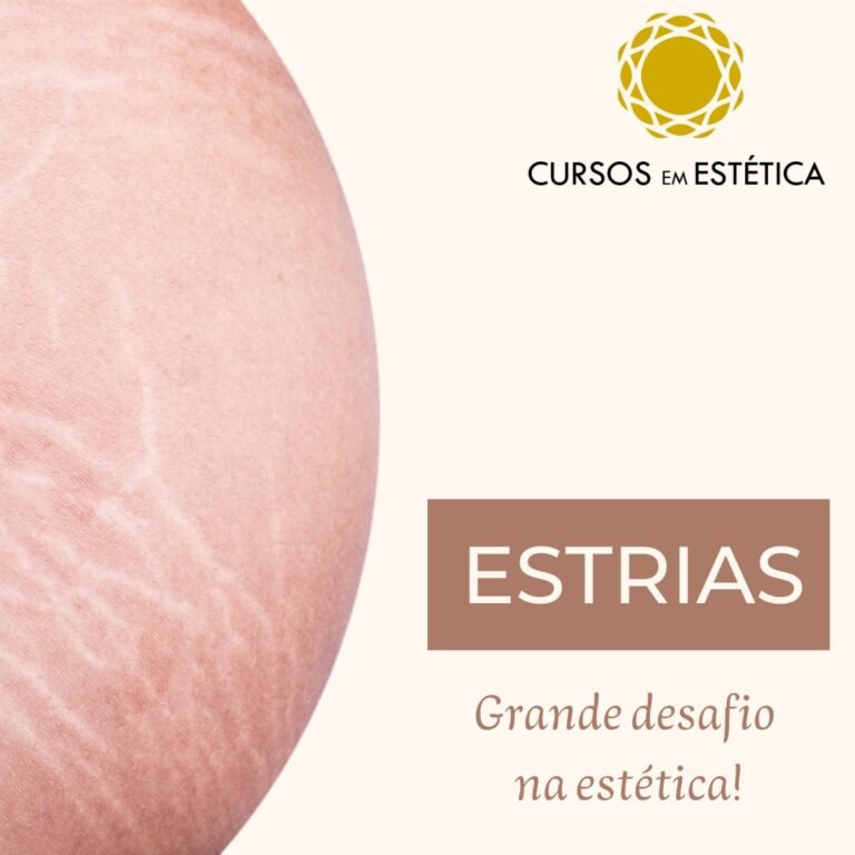 O Que São Estrias